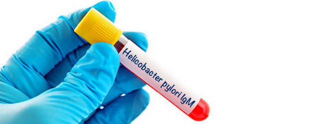 Хеликобактер пилори igm что это – Helicobacter pylori, IgM